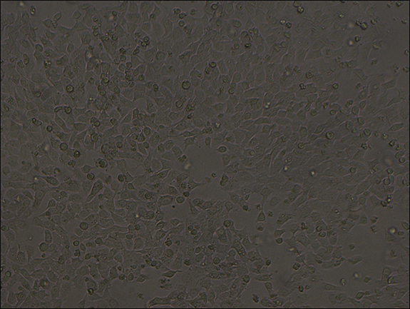 产品详情 - NCI-H1703细胞